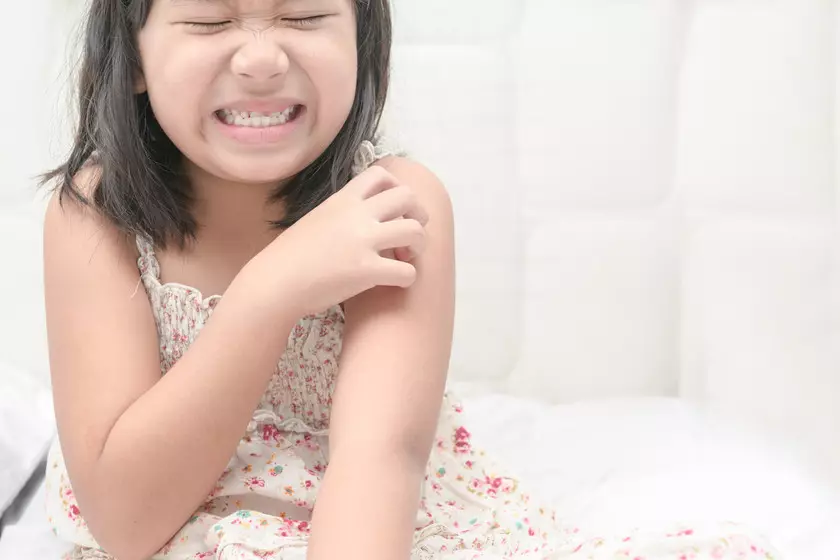 Atopic dermatitis: duk maɓallan don ƙarin fahimtar wannan cutar ta fata