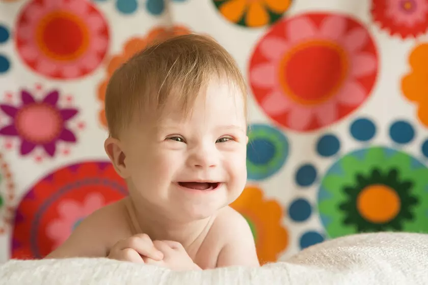 When your baby is born with Down syndrome: how to deal with the diagnosis