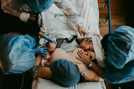 Best-Birth-photos-2022