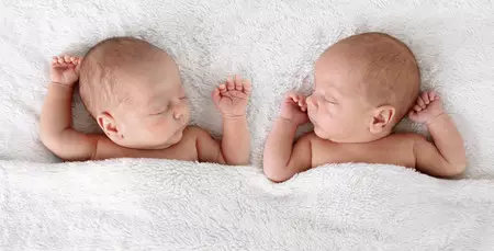 Kembar yang dilahirkan melalui operasi caesar memiliki risiko lebih tinggi mengalami masalah perkembangan psikologis.
