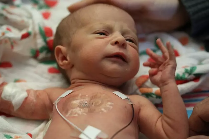 Dvije prijevremeno rođene bebe umrle su u bolnici Vall d'Hebron od bakterije koja je zarazila još osam novorođenčadi