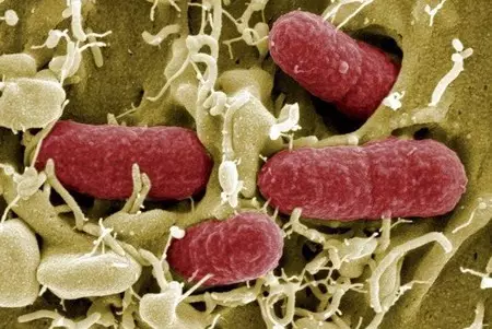 e.coli