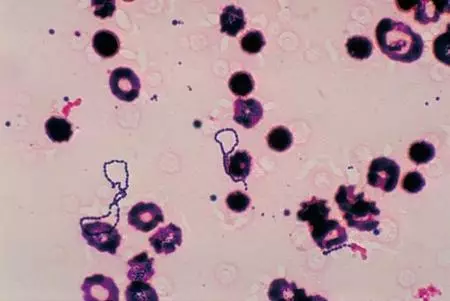 Streptococcusok