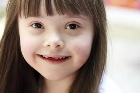 girl-with-down-syndrome