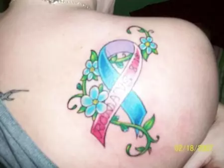 tatovering-abort