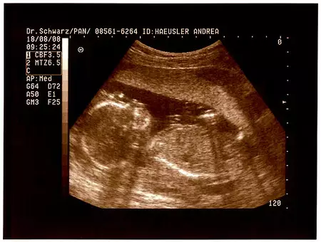 Baby at week 16