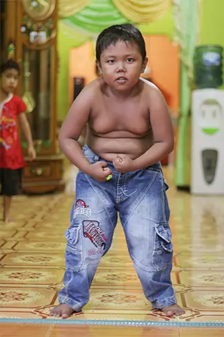 Dijete s prekomjernom težinom pušača