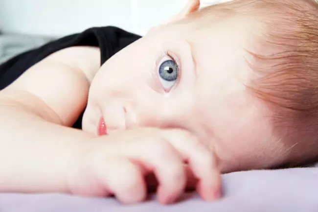 MD EyeCare, aplikasi yang dapat digunakan untuk mendeteksi retinoblastoma dan penyakit mata lainnya pada bayi dan anak-anak