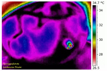 Thermal photography of lactation