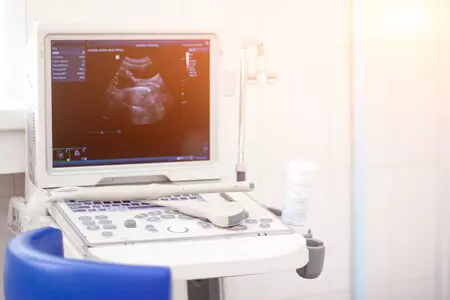 Gynecological ultrasound kapag may mga problema sa kawalan ng katabaan: kung ano ang diagnose nito at kung kailan ito gagawin