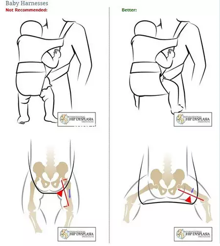 Position correcte dans le sac à dos ergonomique