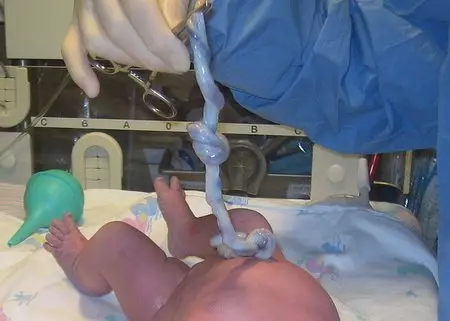 baby-and-umbilical-cord2.jpg