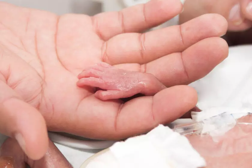 Il bambino più prematuro del mondo, che alla nascita pesava 212 grammi, è stato dimesso dopo un anno in ospedale