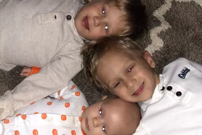 Drie broers zijn gediagnosticeerd met retinoblastoom, een zeldzame oogkanker bij kinderen