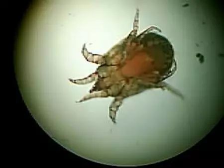 scabies 2