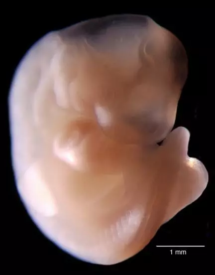 Embrioni tre javë