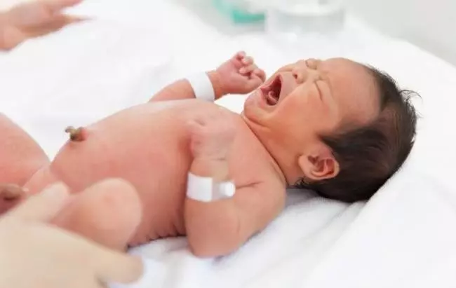 A köldökzsinór az újszülöttben: minden, amit tudnod kell