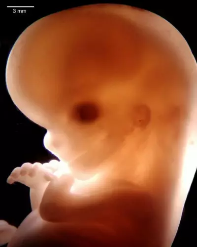 懷孕九週的胚胎