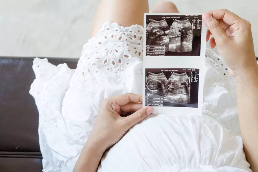 Woch 12 vun der Schwangerschaft: den Ultraschall vun den 12 Wochen