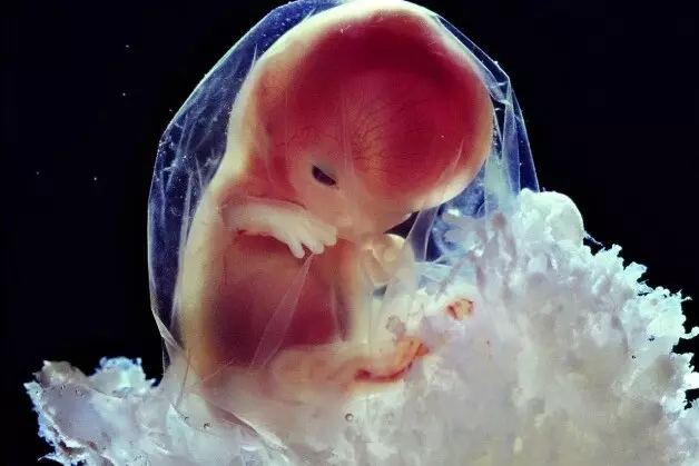 13-та недела од бременоста: минијатурно човечко суштество