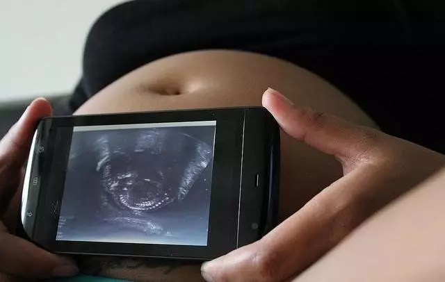 21 недела од бременоста: започнува втората половина од бременоста