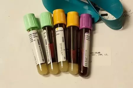 Blodprøve