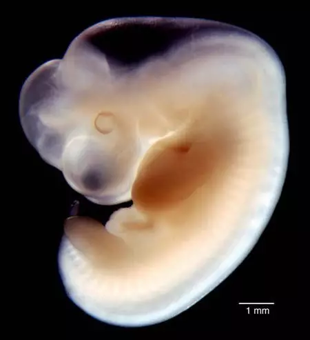 trudnoća sedmicu po sedmicu na slikama: fetus 5 sedmica