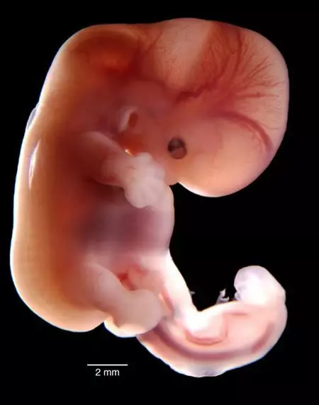 shtatzënia javë pas jave në foto: fetusi 6 javësh