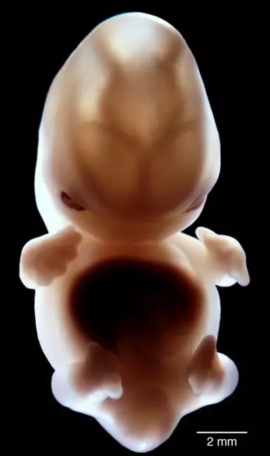 pamuviri vhiki nevhiki mumifananidzo: 7 vhiki fetus