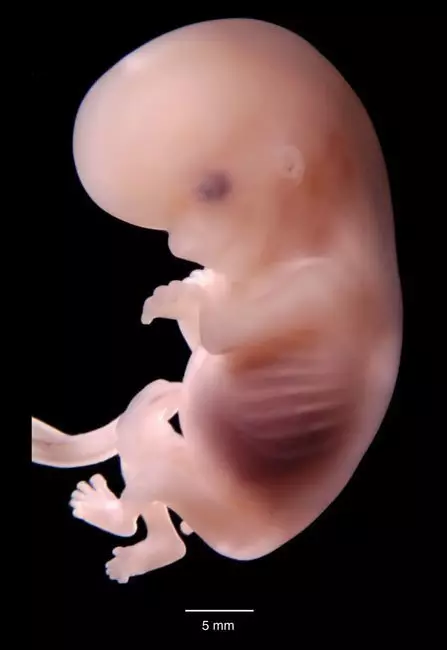 ການຖືພາອາທິດຕໍ່ອາທິດໃນຮູບ: fetus 8 ອາທິດ