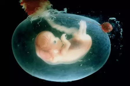 Imazhet e shtatzënisë javë pas jave: fetusi 10 javësh