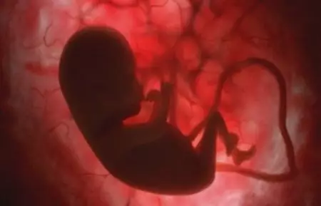 ຮູບພາບການຖືພາອາທິດໂດຍອາທິດ: fetus 12 ອາທິດ