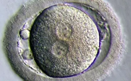 ovule