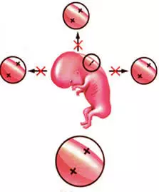 የ nuchal fold መለኪያ ምንድን ነው?