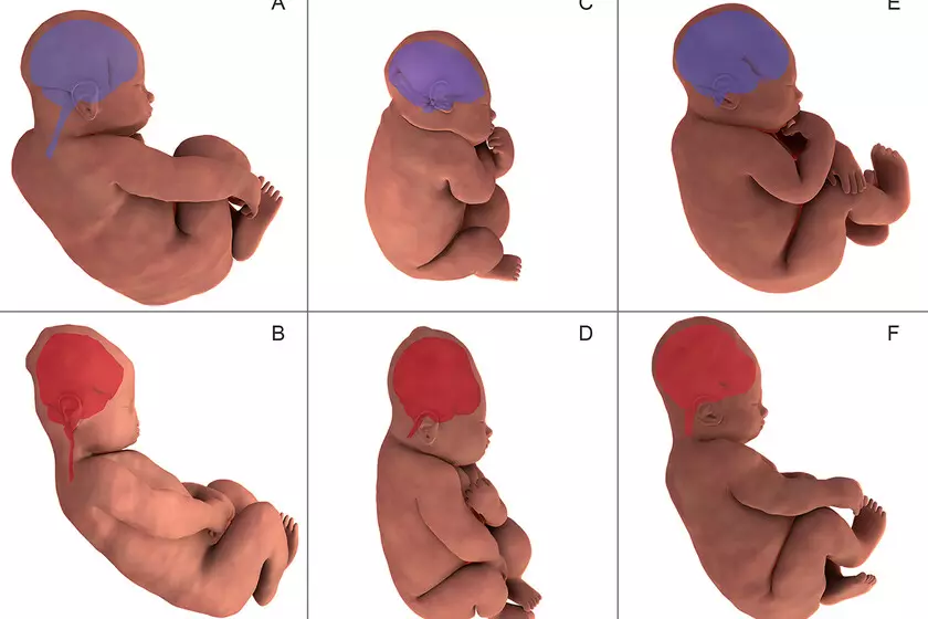Ето как главата на бебето се деформира по време на раждане, за да се улесни преминаването му през таза на майката
