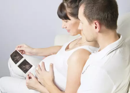 Zukünftige Eltern schauen sich einen Ultraschall an