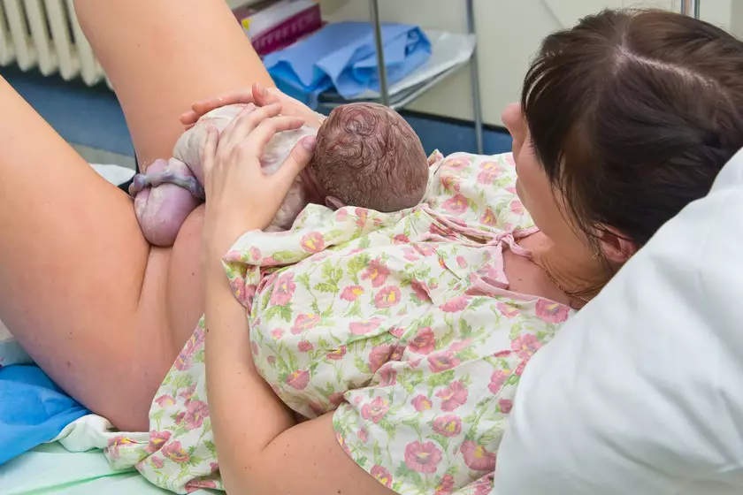 Babys berne mei in knoop yn 'e navelstreng