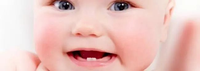 Como limpar os dentes do bebê