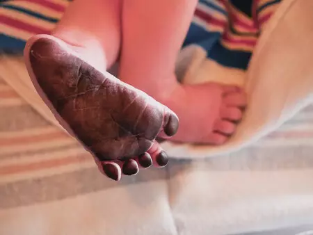 जन्म के समय, मां और बच्चे के पैरों के निशान (आमतौर पर पैर से) लिए जाते हैं, और उन्हें अस्पताल द्वारा जारी पहचान दस्तावेज में पंजीकृत किया जाता है, जिसमें नवजात कोडर के साथ एक स्टिकर जोड़ा जाता है। . उन्हें स्याही से या बायोमेट्रिक सिस्टम के माध्यम से लिया जा सकता है।
