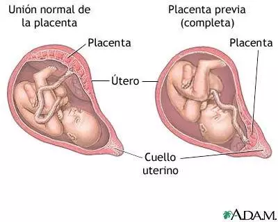 Çfarë është placenta: gjithçka për organin e vetëm të përkohshëm që formohet gjatë shtatzënisë