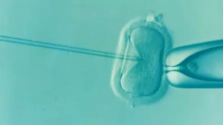 Icsi intrasitoplazmik sperma in'ektsiyasi