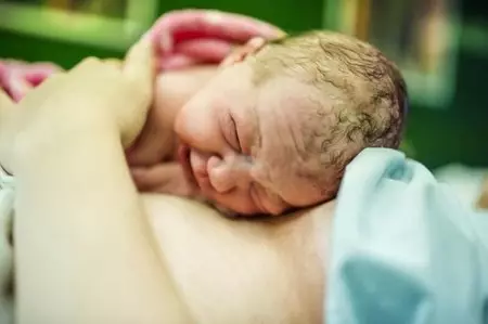 awọn apakan caesarean